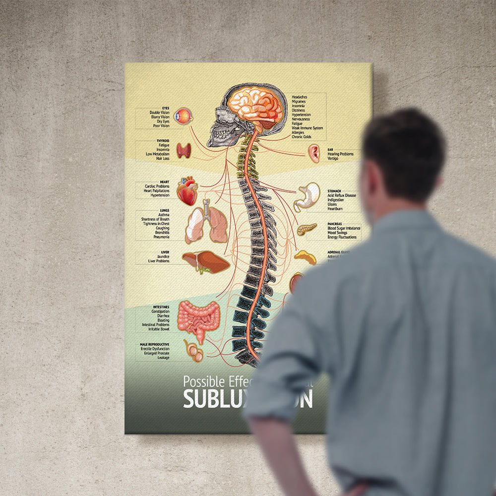 Subluxation Spine Chart - Chiropractic Patient Education Poster ...