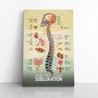 Subluxation Spine Chart - Chiropractic Patient Education Poster ...